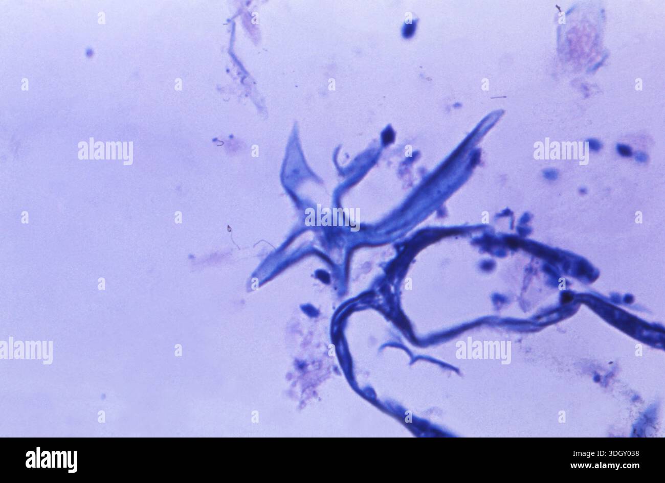 Mucor hyphae hi-res stock photography and images - Alamy