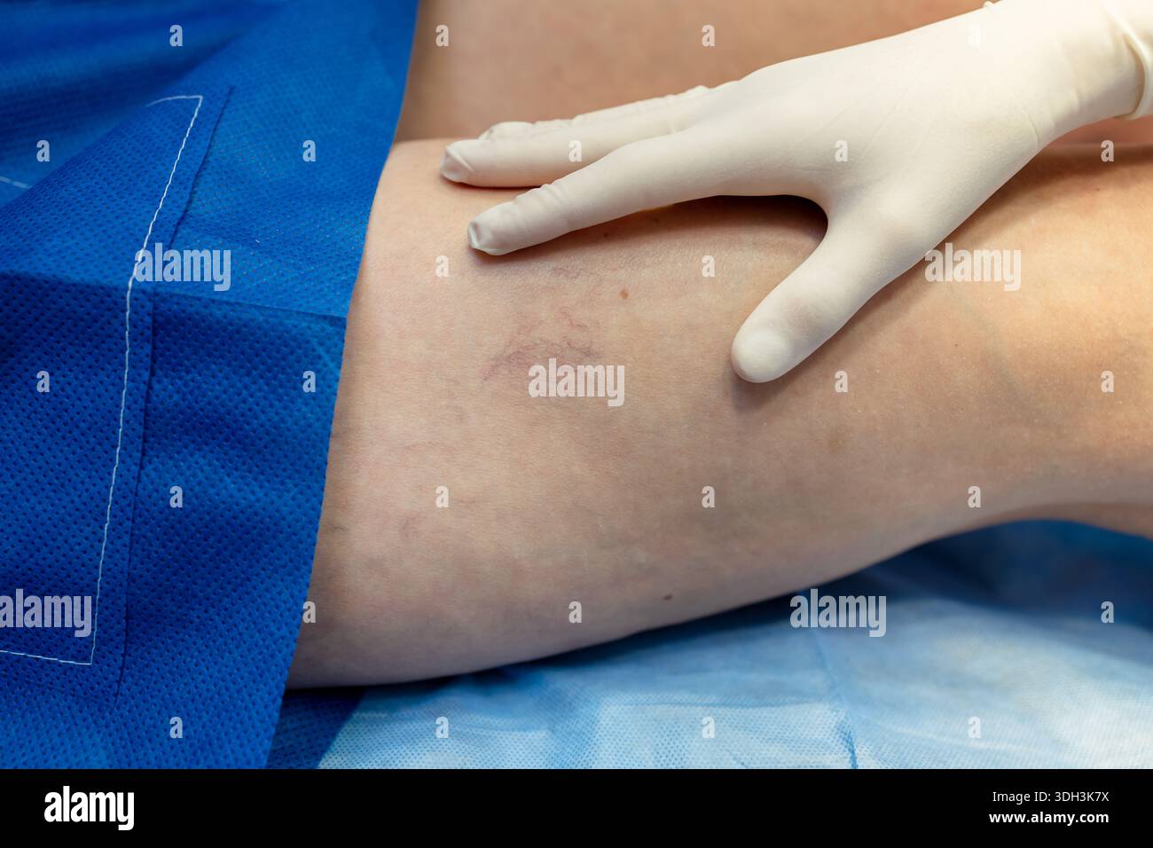 Vascular specialist examining patient leg veins through visual ...