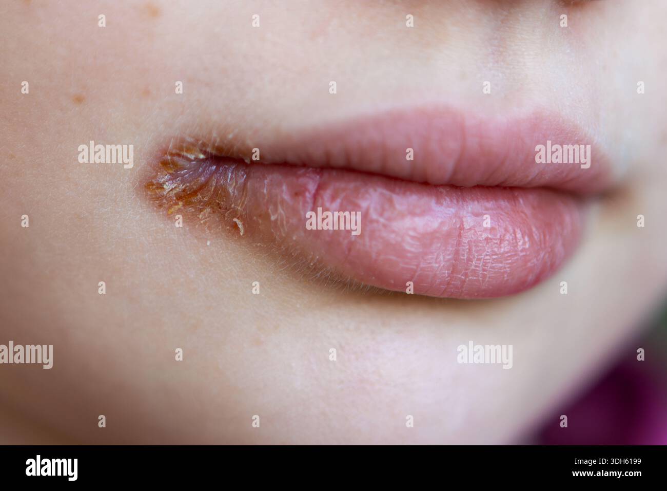 Facialskin hi-res stock photography and images - Alamy
