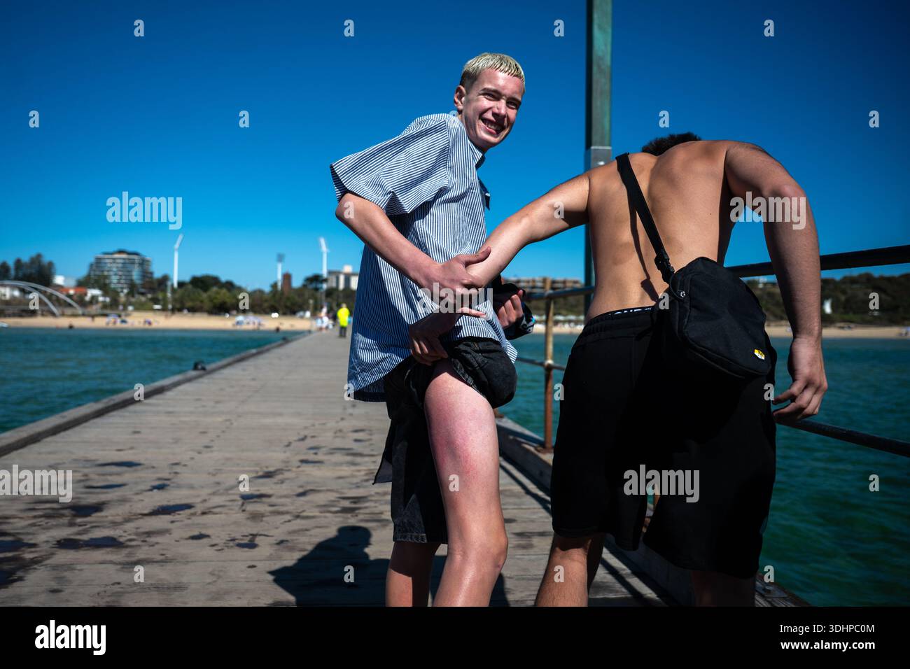 Nick Hansson, 16, was stung by a lion's mane jellyfish on the back of ...