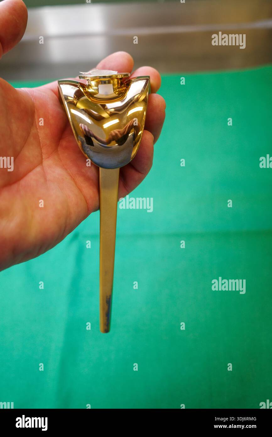 Close-up of a titanium knee implant prosthesis held in a human hand ...