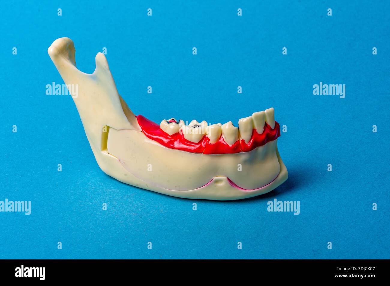 Dental model showing molars hi-res stock photography and images - Alamy