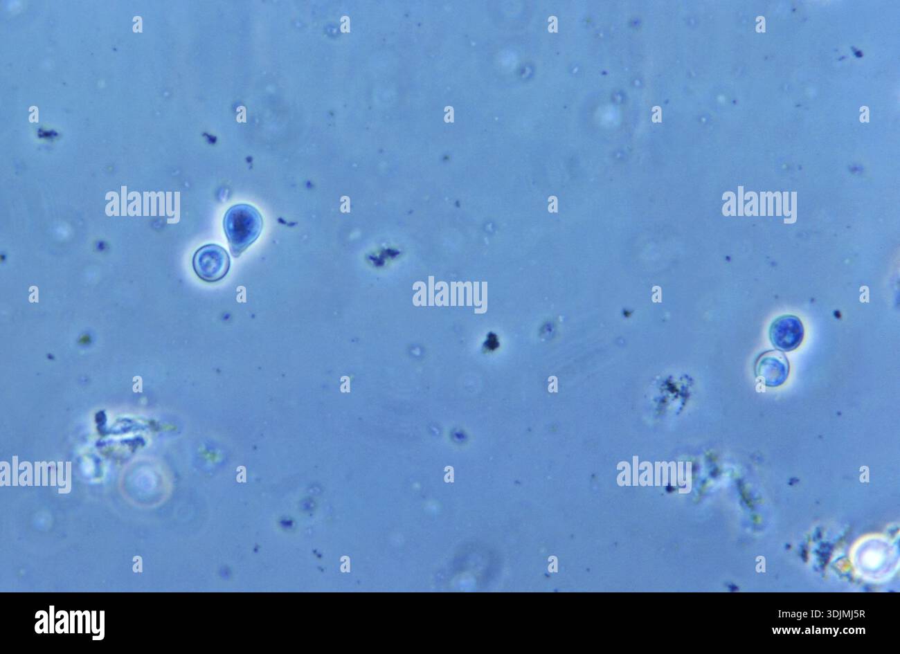Lpcb hi-res stock photography and images - Alamy