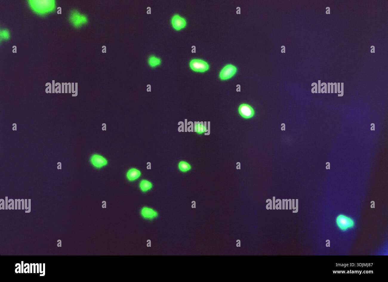 A fluorescent antibody stain highlights Gram-positive Streptococcus ...