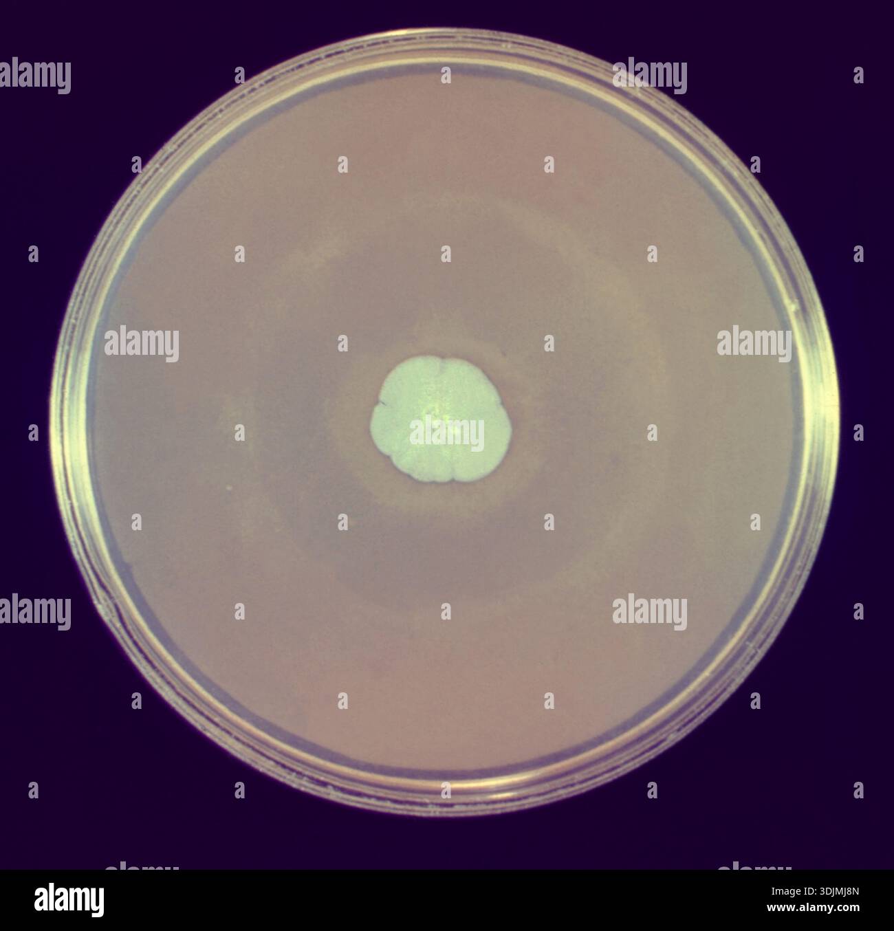 Cryptococcus dish hi-res stock photography and images - Alamy