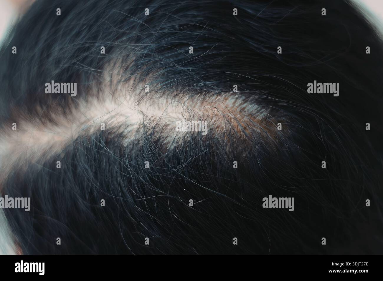 A detailed close-up photograph of a section of hair, showing the scalp ...