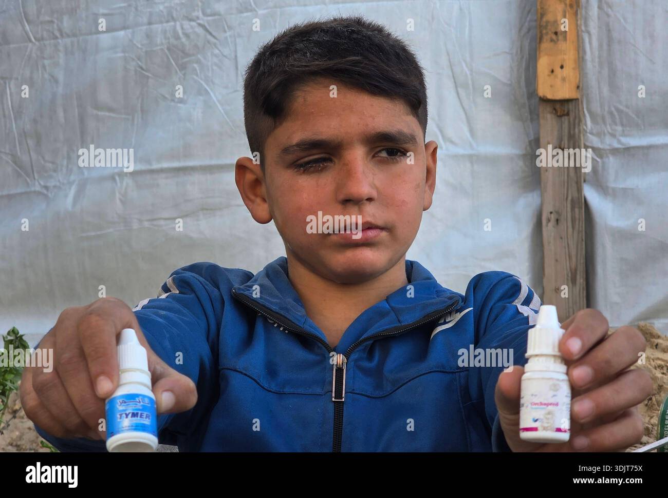 Nine-year-old Abdul Rahman al-Sharafi is at risk of losing his sight ...