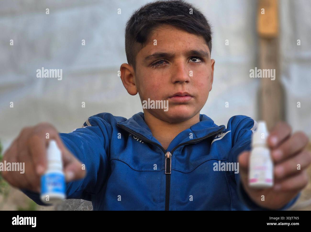 Nine-year-old Abdul Rahman al-Sharafi is at risk of losing his sight ...
