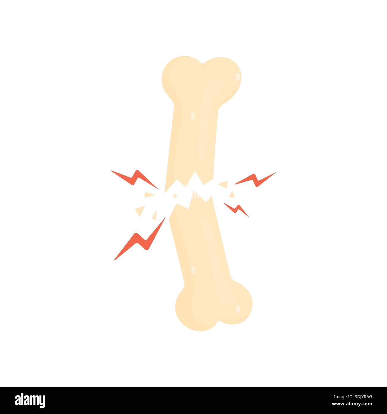 Bone fracture icon. Bone injuries. Broken human bone Stock Vector Image ...