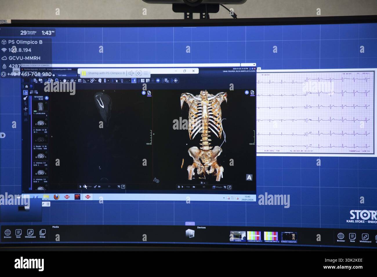 Milan, Niguarda Hospital, Inauguration and ribbon-cutting ceremony of ...