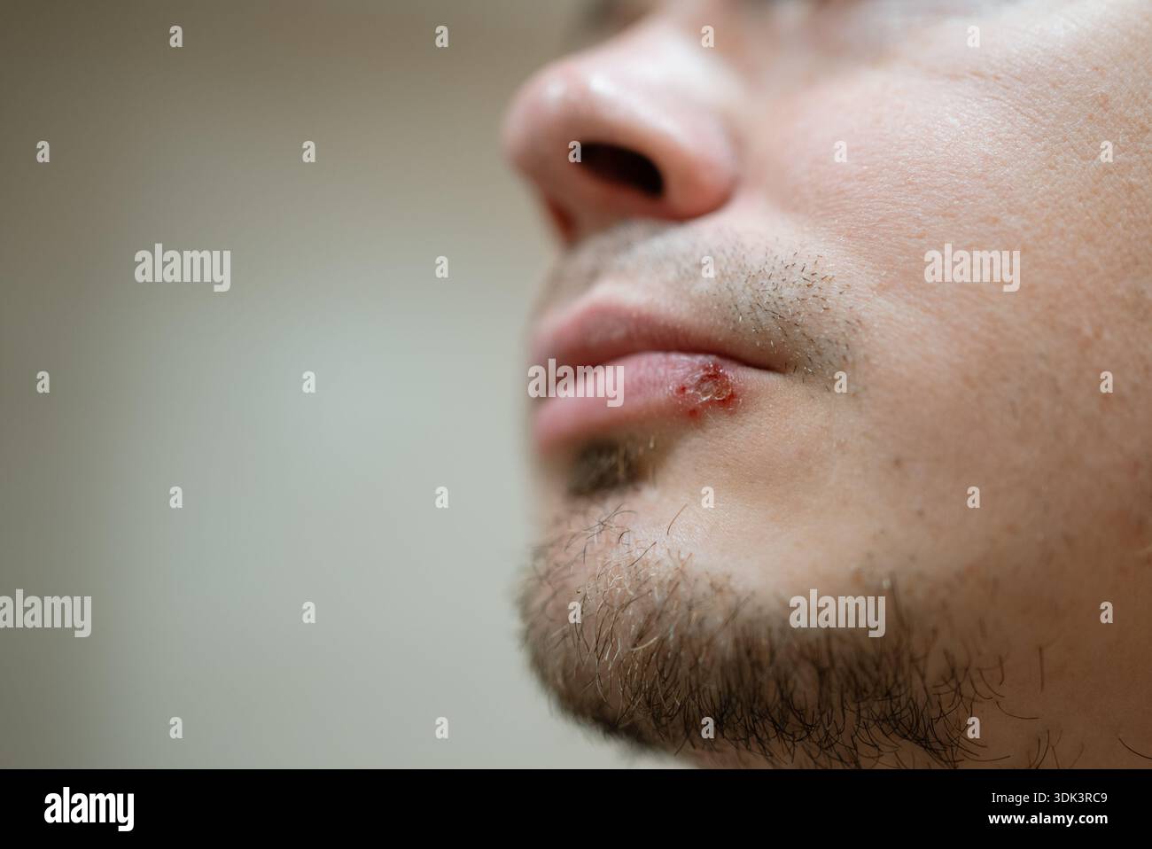 Immunology common cold hi-res stock photography and images - Alamy