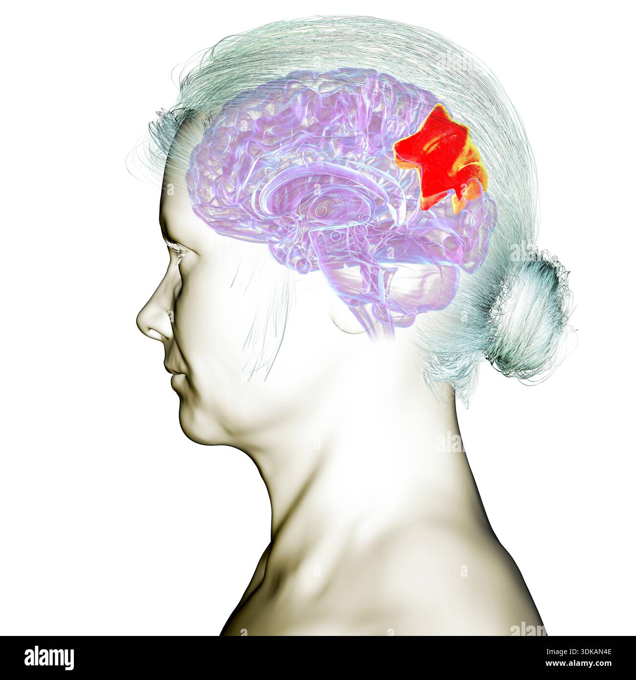 Illustration of the human brain with highlighted precuneus gyrus. This ...