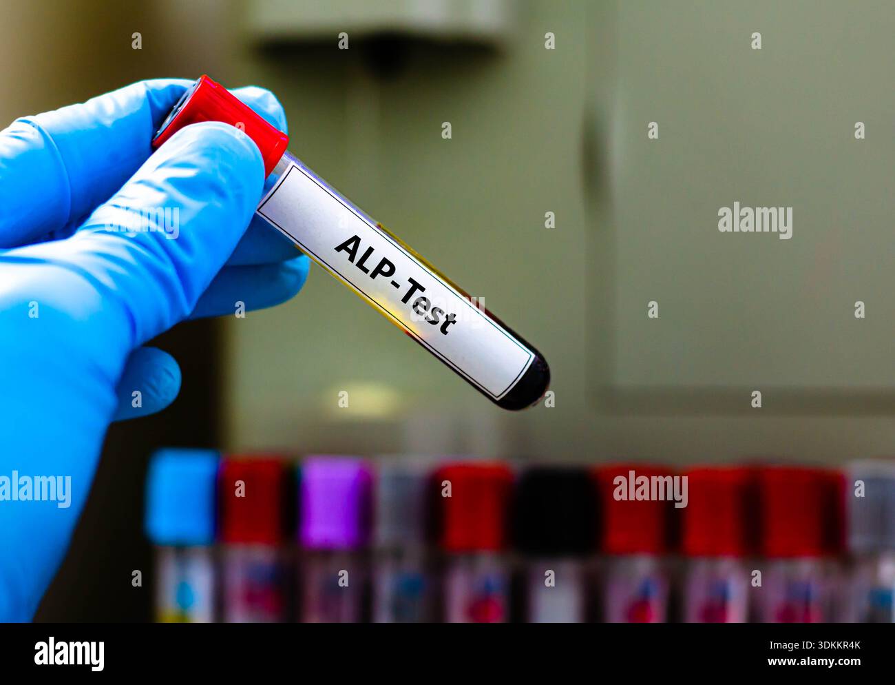 Clinical sample test background hi-res stock photography and images - Alamy