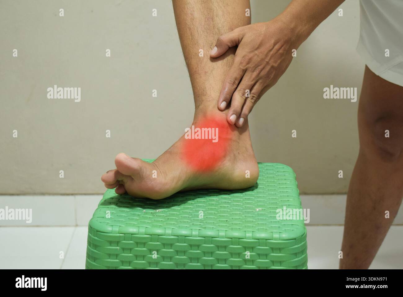 Male foot pain and inflammation, joint disease, hallux valgus, plantar ...