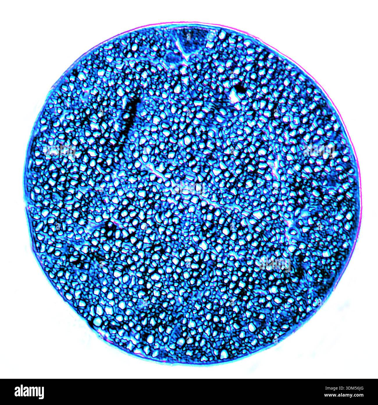 Light micrograph showing a transverse section of a nerve, revealing its ...