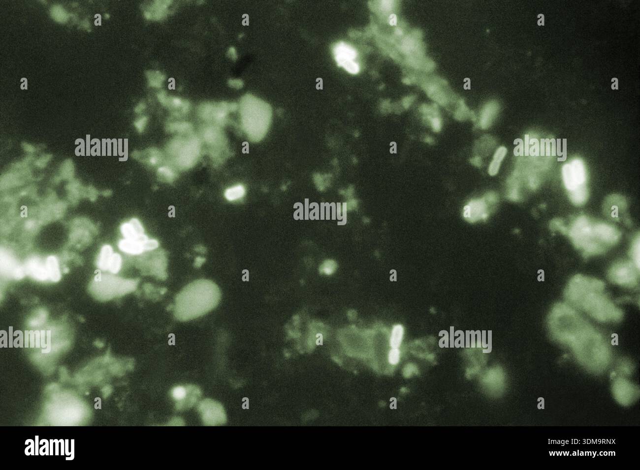 Fecal smear technique hi-res stock photography and images - Alamy