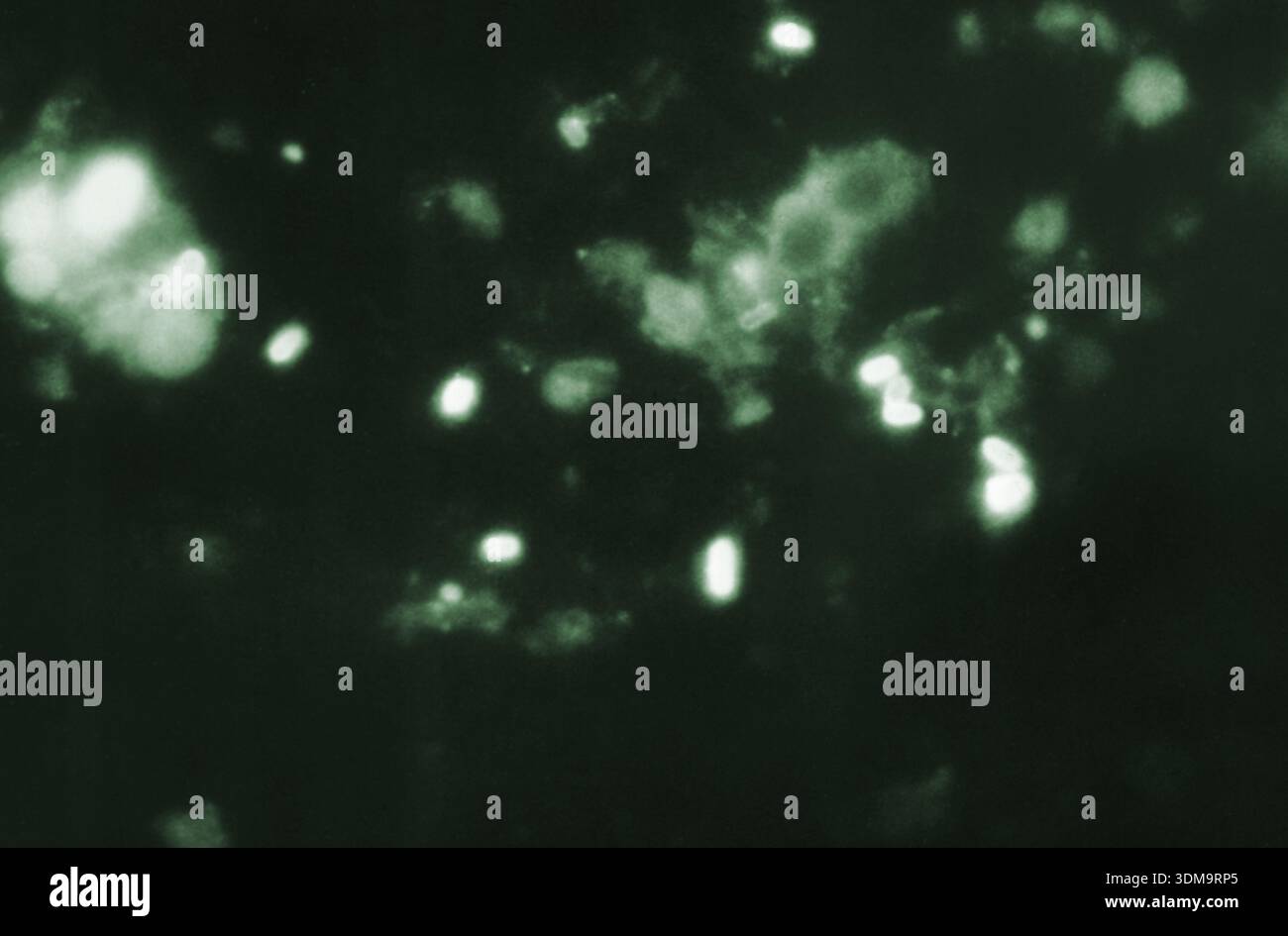 Fecal smear technique hi-res stock photography and images - Alamy