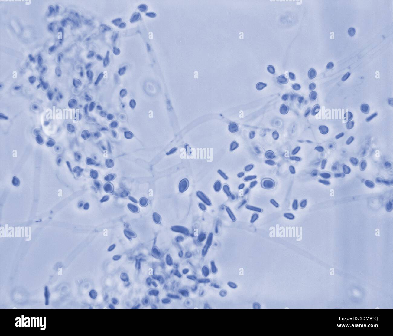 Photomicrograph at 500X shows septate filamentous hyphae and numerous ...