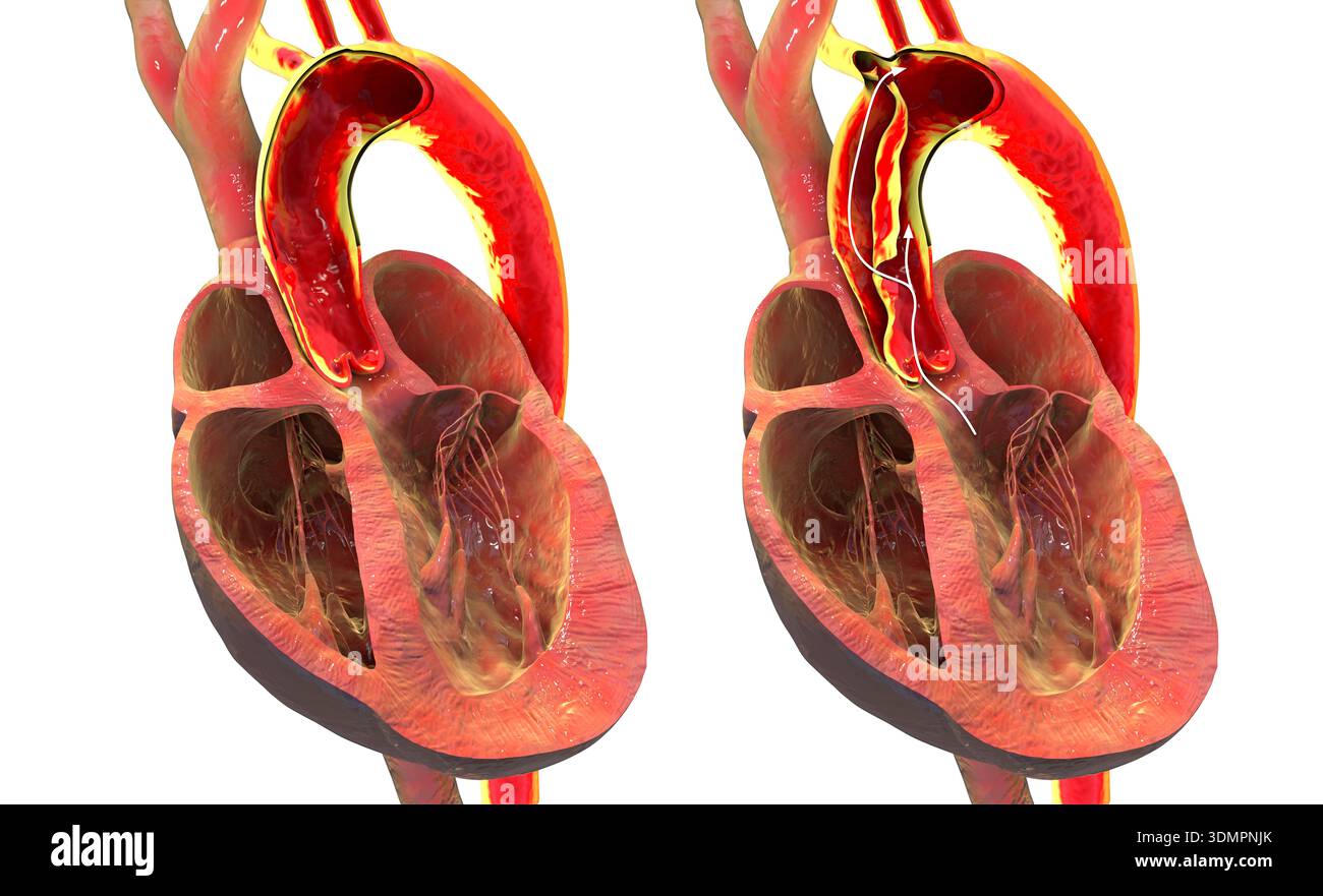 Normal and pathological hi-res stock photography and images - Alamy
