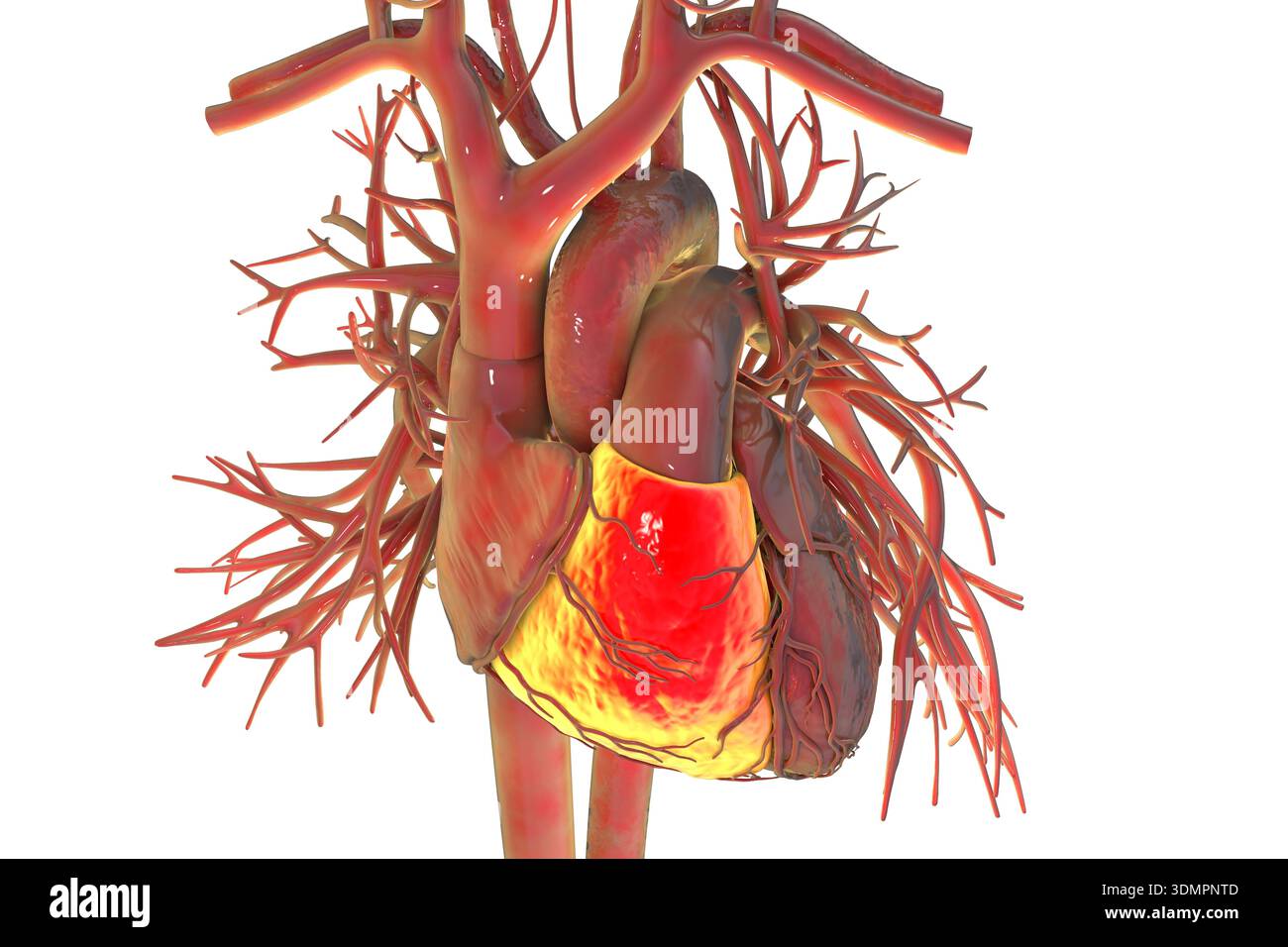 Illustration of the human heart with right ventricle highlighted. The ...