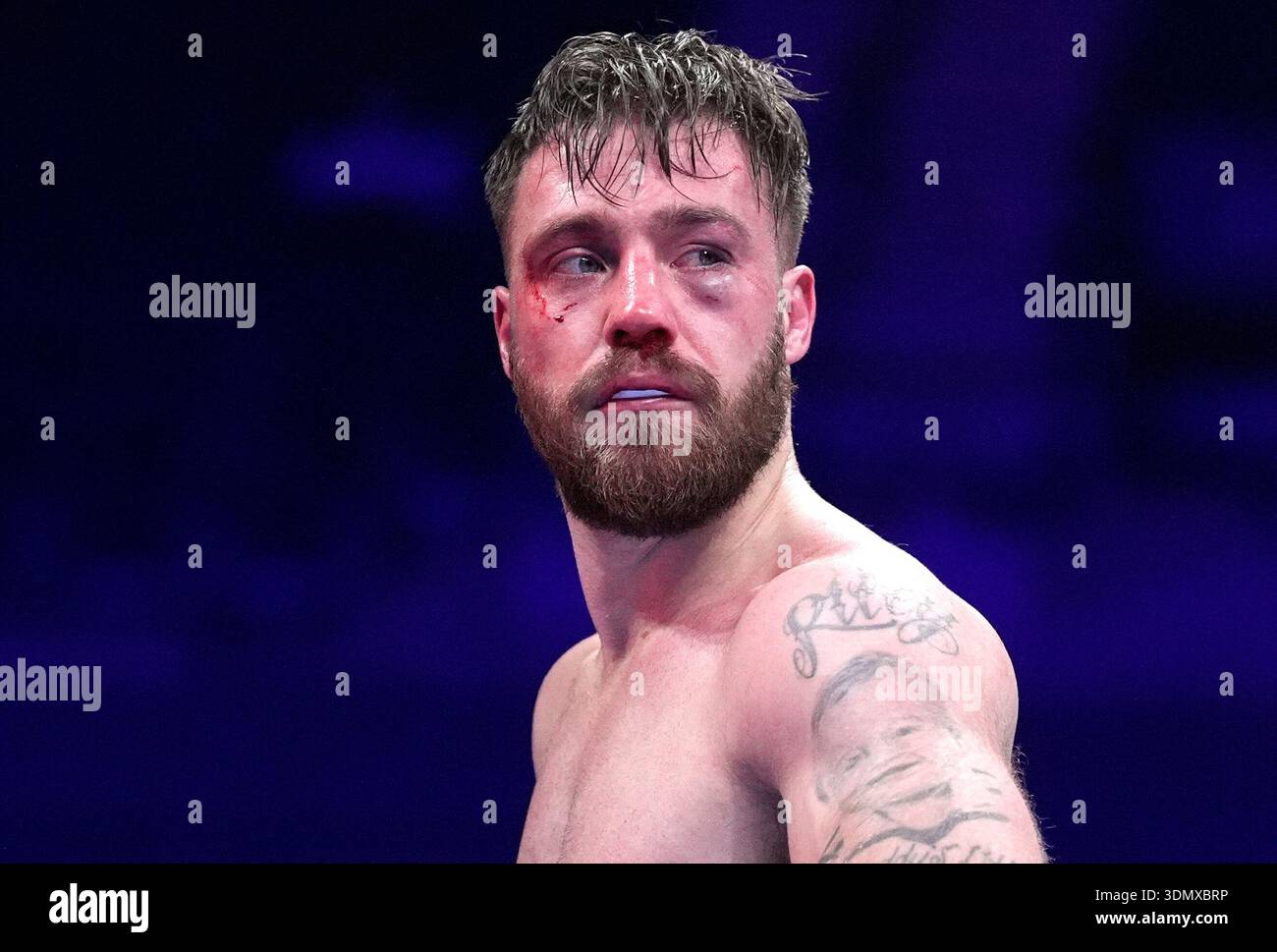 Jack England in the super feather weight bout at the M&S Bank Arena ...