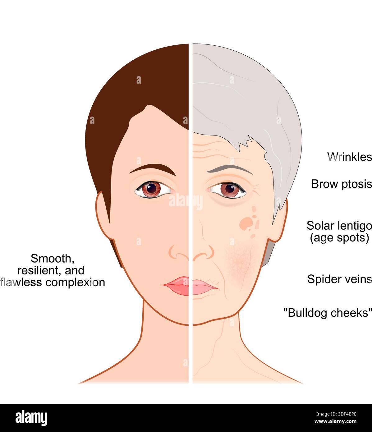 Dermatoheliosis hi-res stock photography and images - Alamy
