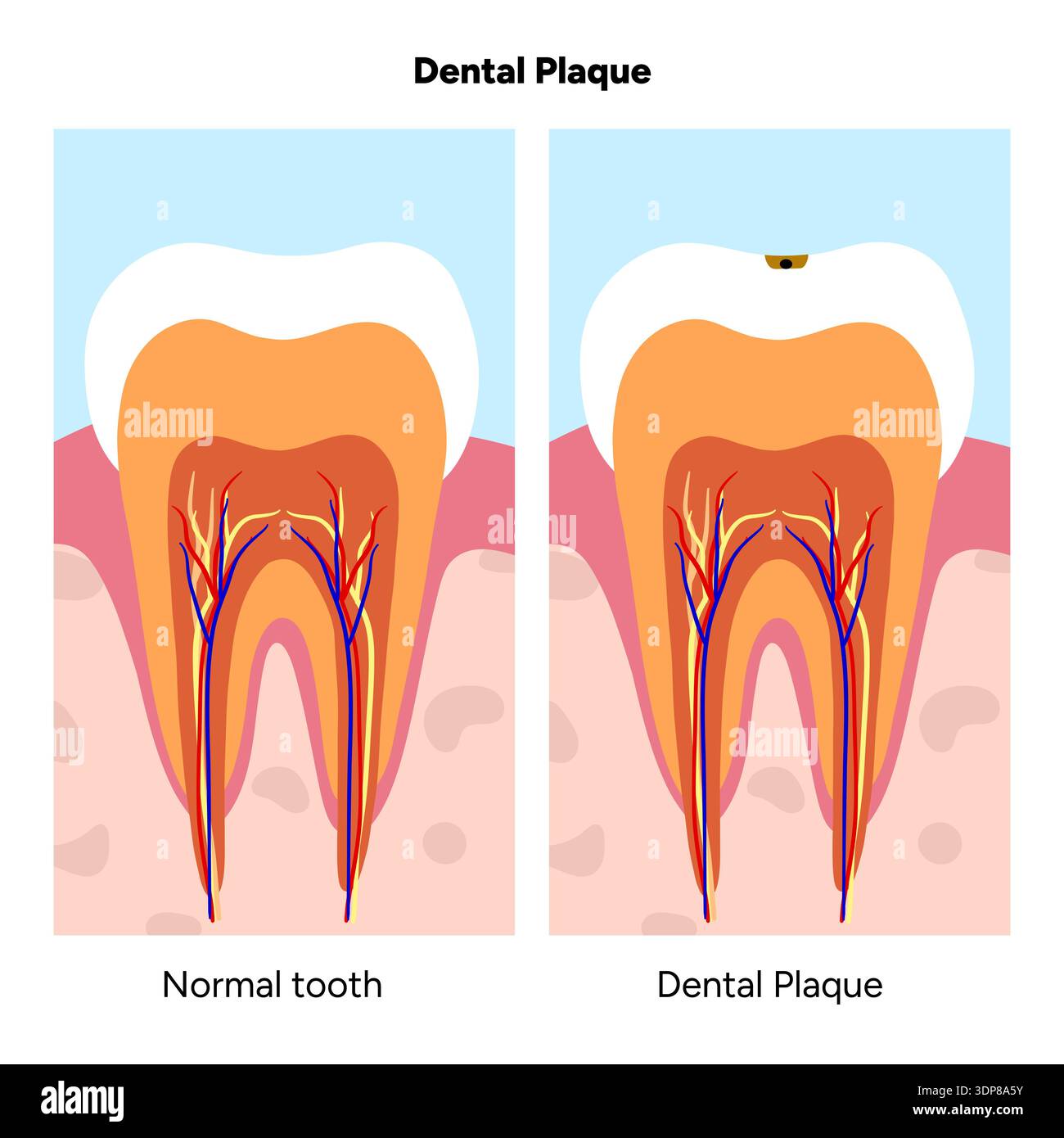 Hand-drawn dental infographic illustrating the formation of dental ...