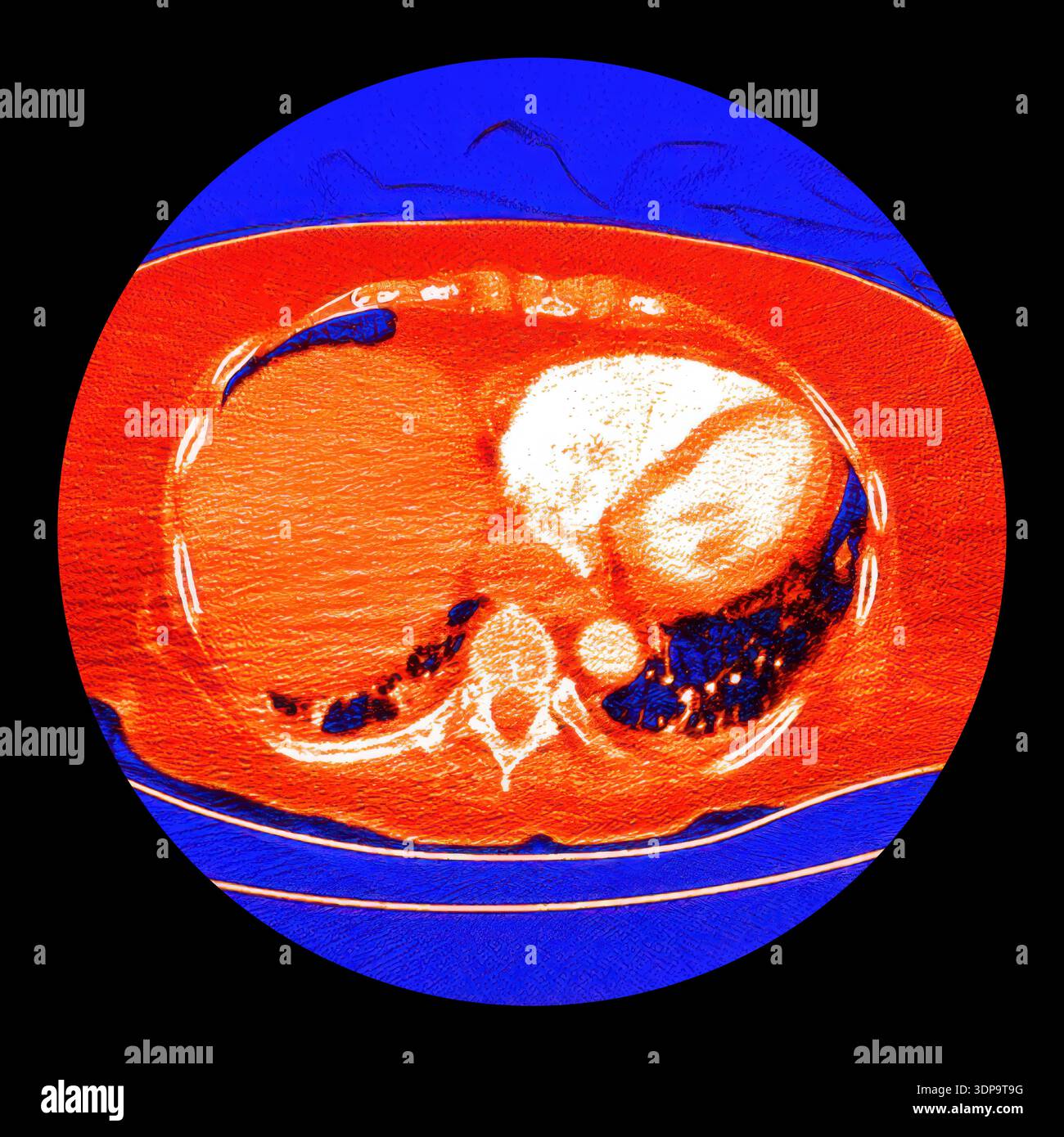 Perfusion scan hi-res stock photography and images - Alamy