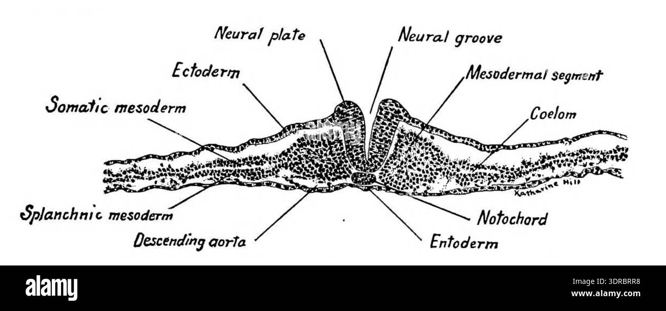 This image shows a transverse section of the fifth pair of mesodermal ...
