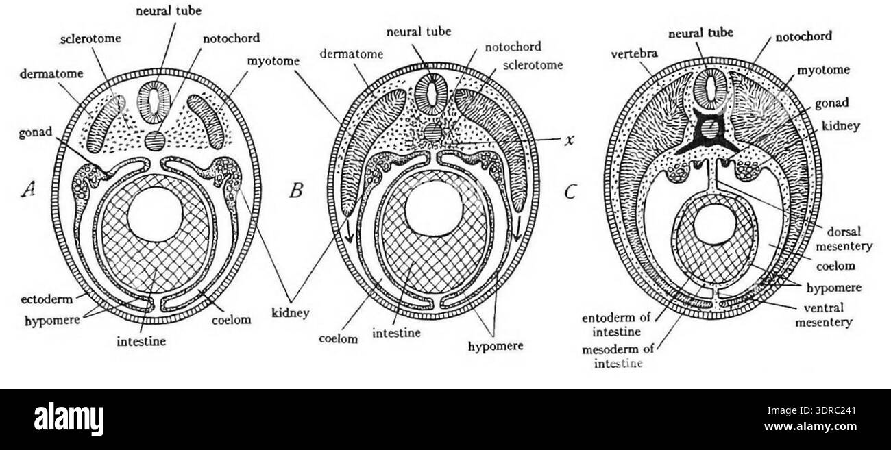 Showing differentiation of the epimere into dermatome hi-res stock ...