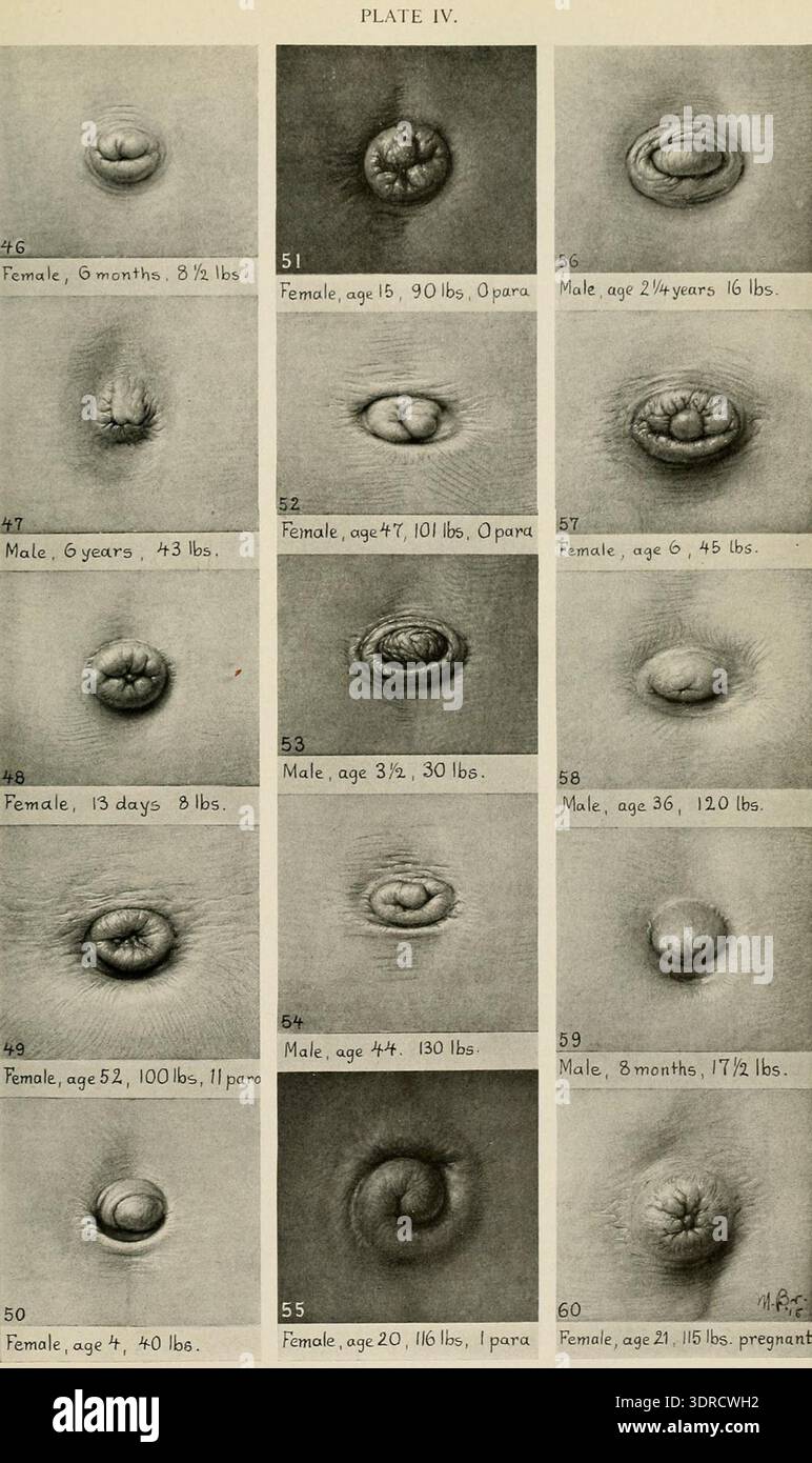 Diversity of anatomical forms hi-res stock photography and images - Alamy