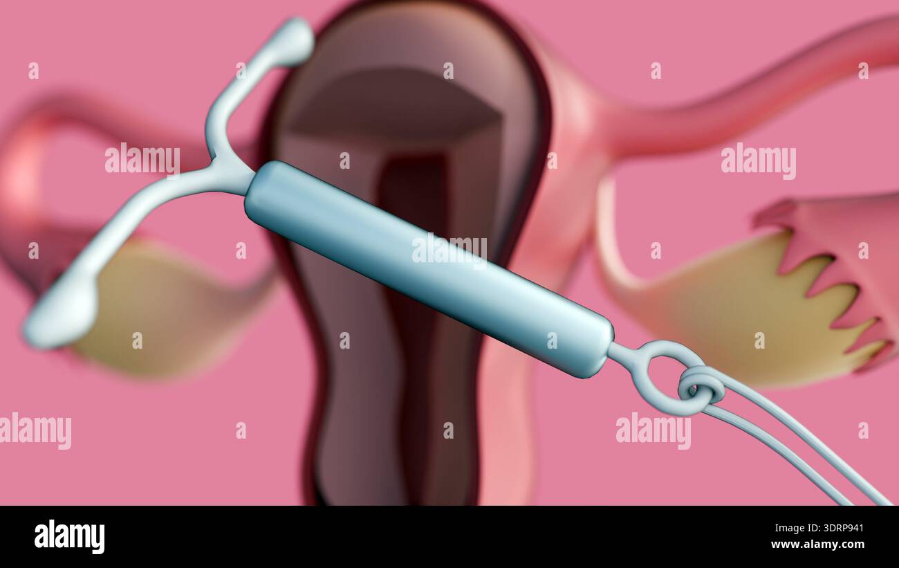 A 3D rendering of a cross-sectional view of the female reproductive ...