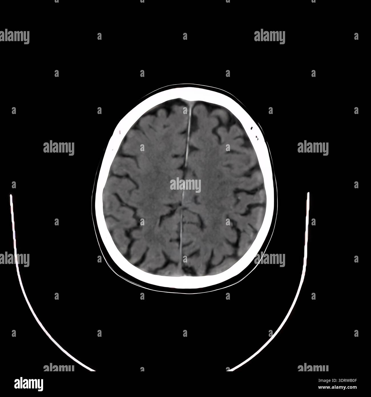 Cross section of the human eye hi-res stock photography and images - Alamy