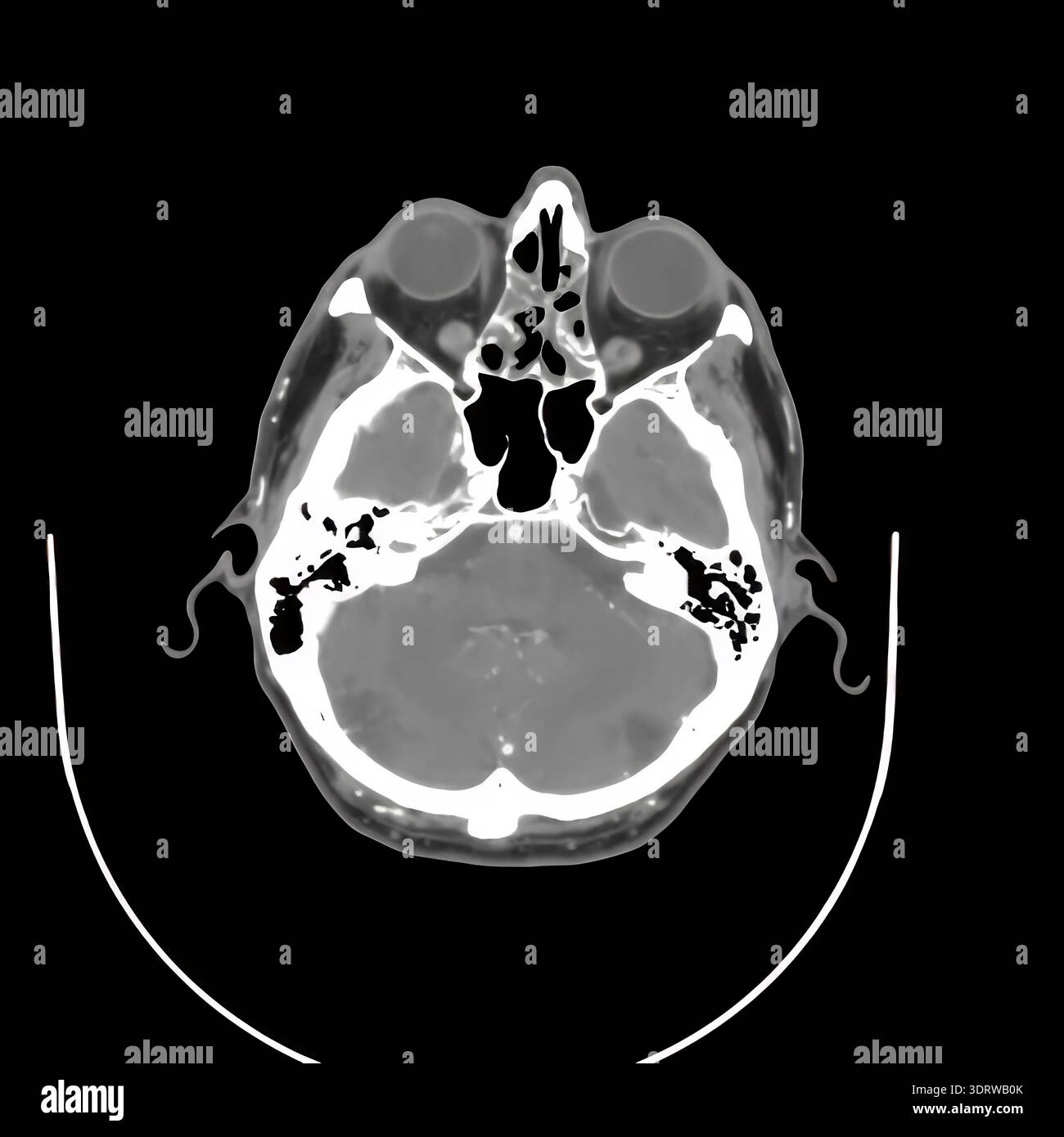 Human head CT scan on a black background displaying internal anatomy ...