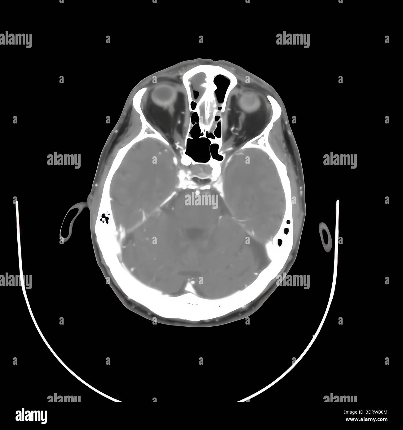Human head CT scan on a black background displaying internal anatomy ...
