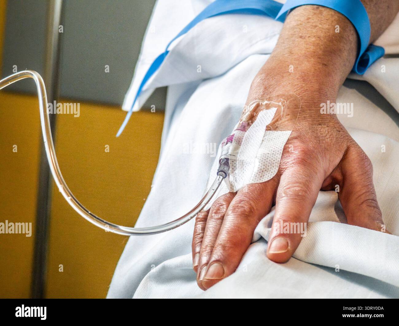 placement of an intravenous vial (peripheral venous catheterization ...