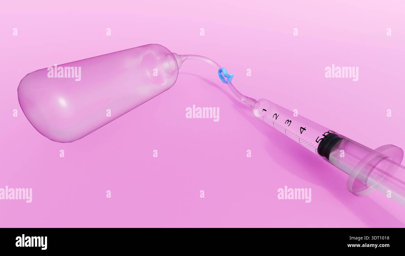 A 3d rendering of vaginal dilator pump specifically a pneumatic or ...