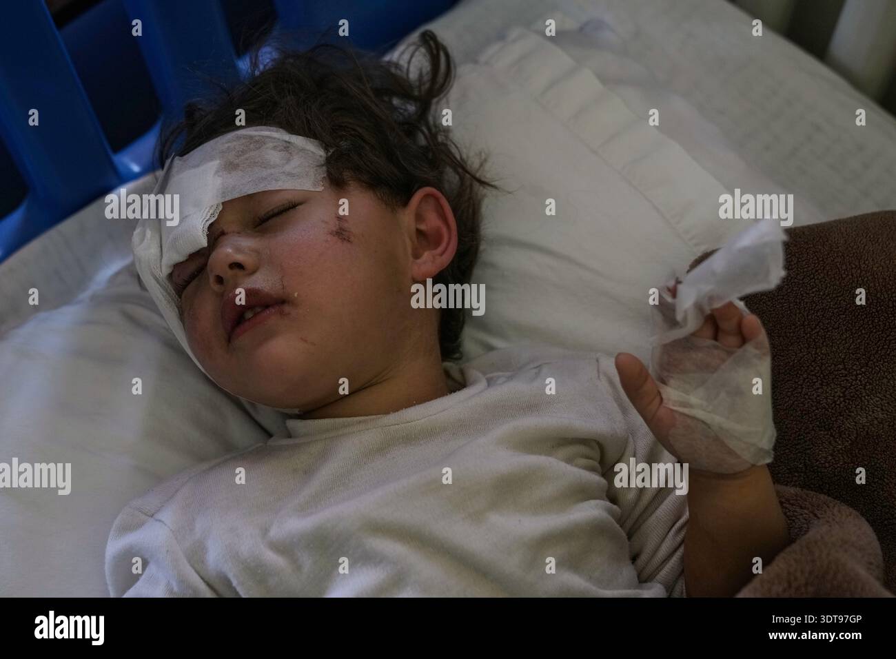Syrian Menisa Taha, who was wounded in an Israeli airstrike, lies in ...