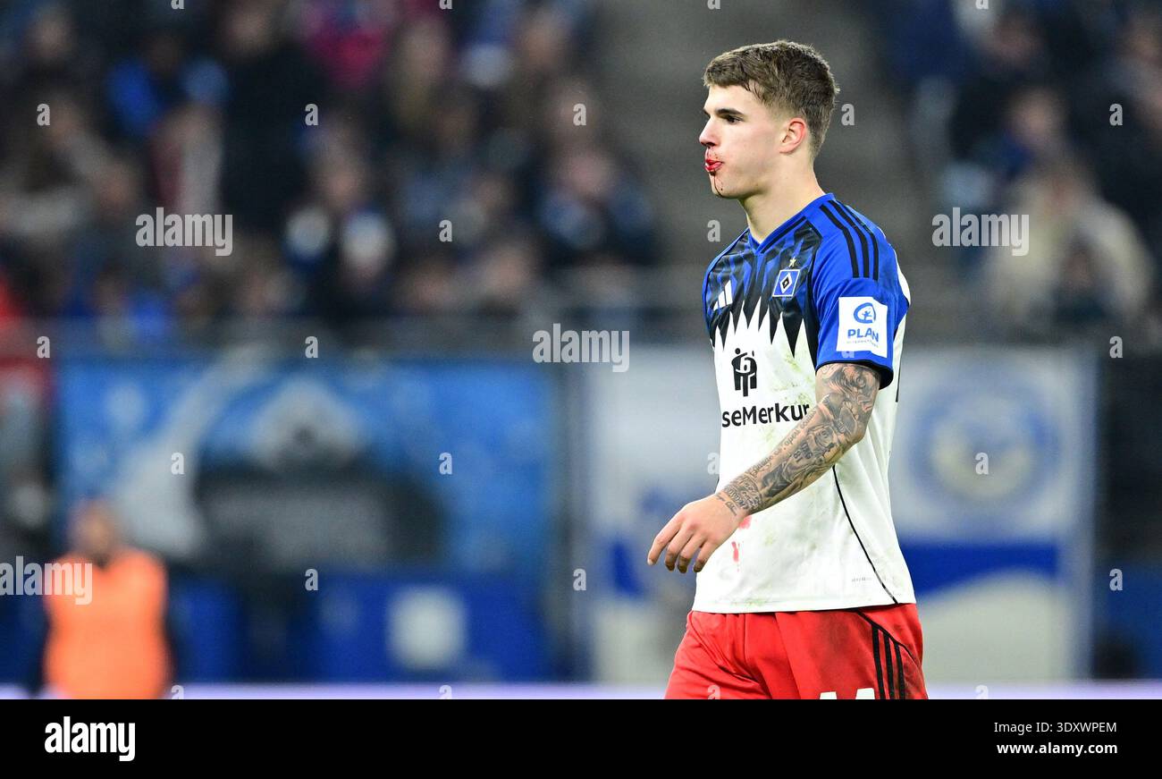 Injury, Luka Vuskovic (HSV Hamburg) Hamburg, March 4, 2026, Football ...