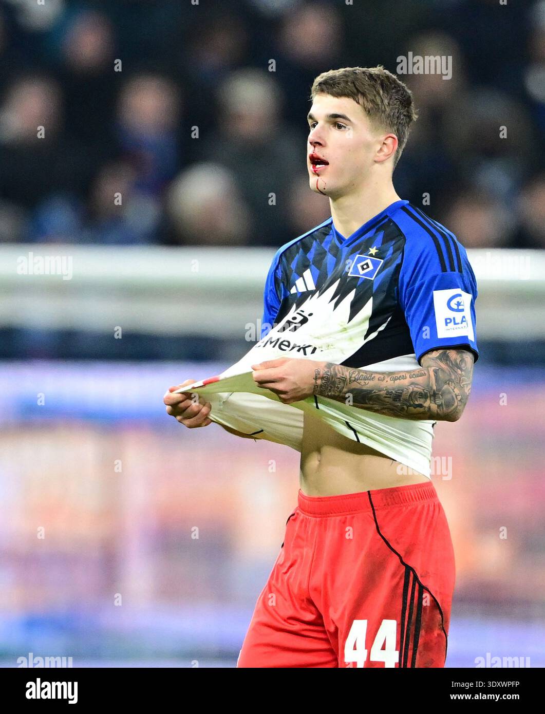 Injury, Luka Vuskovic (HSV Hamburg) Hamburg, March 4, 2026, Football ...