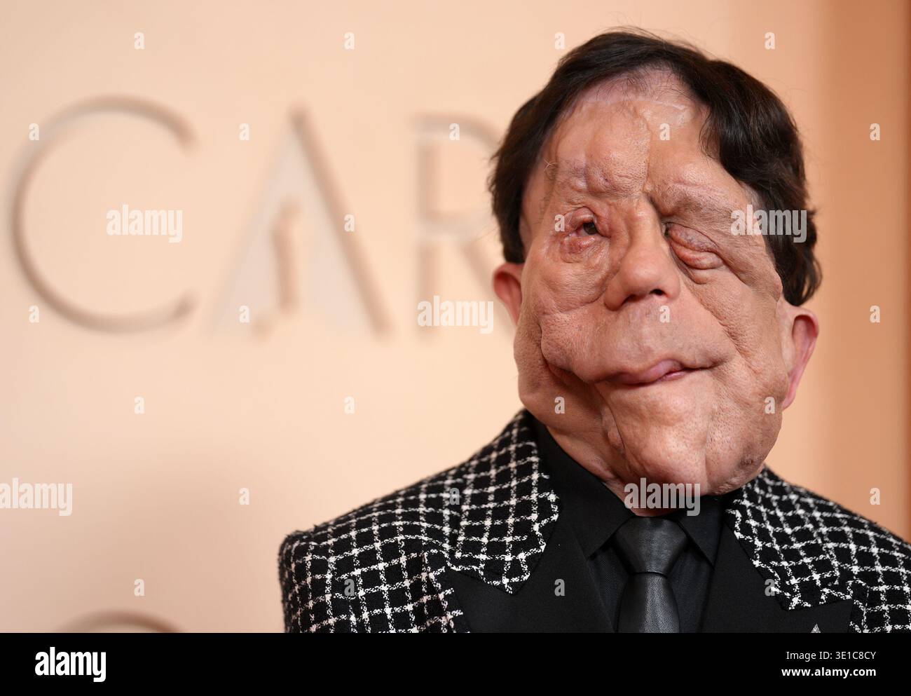 Adam Pearson arrives at the Oscars on Sunday, March 15, 2026, at the ...