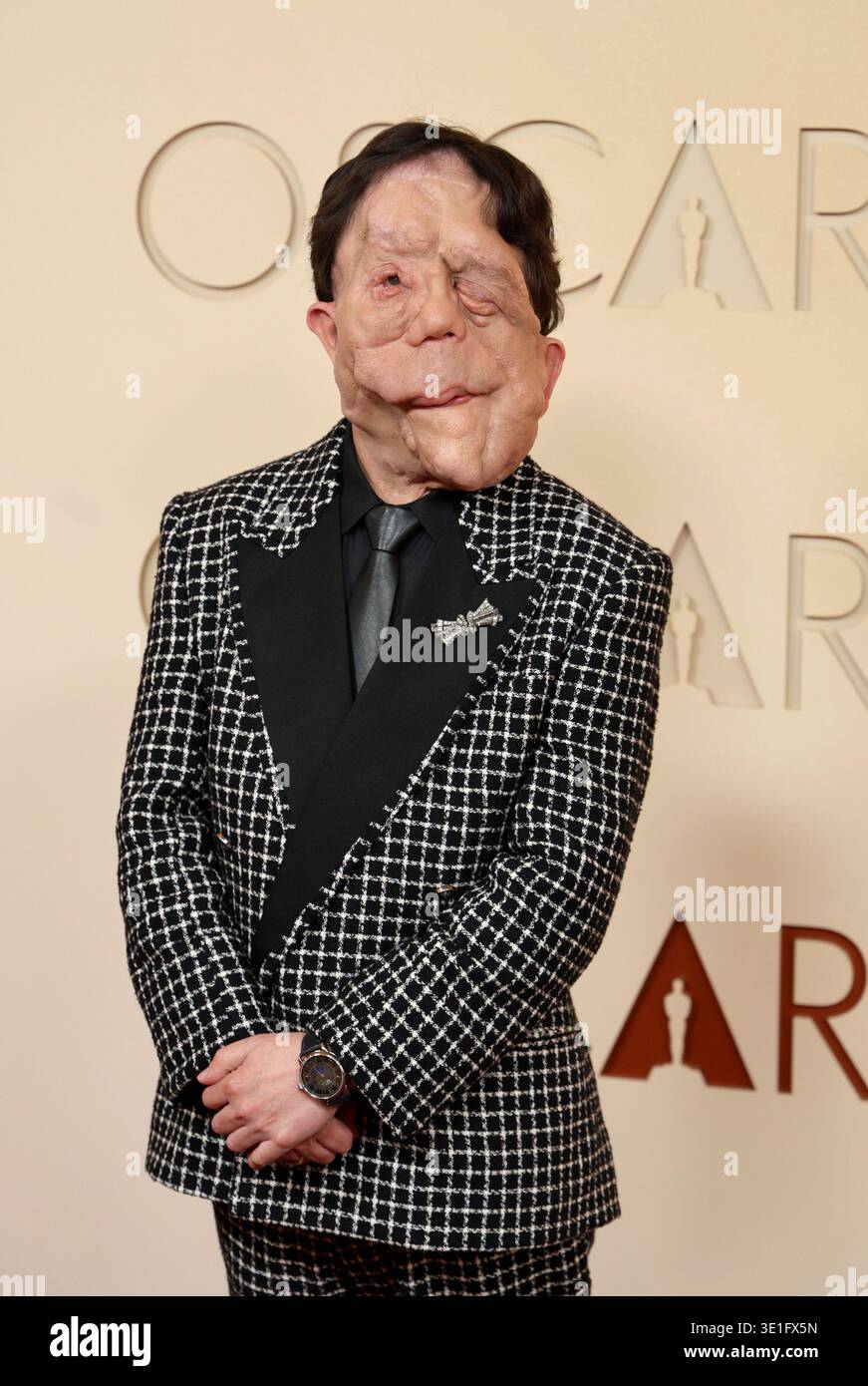 Adam Pearson at the 98th Annual Academy Awards held at Dolby Theatre in ...