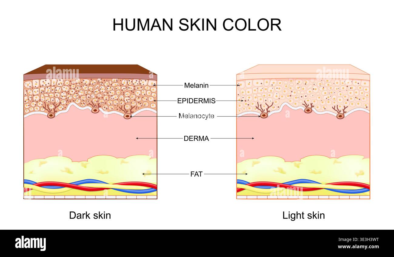 Human skin color. Different between Light and Dark skin. skin ...