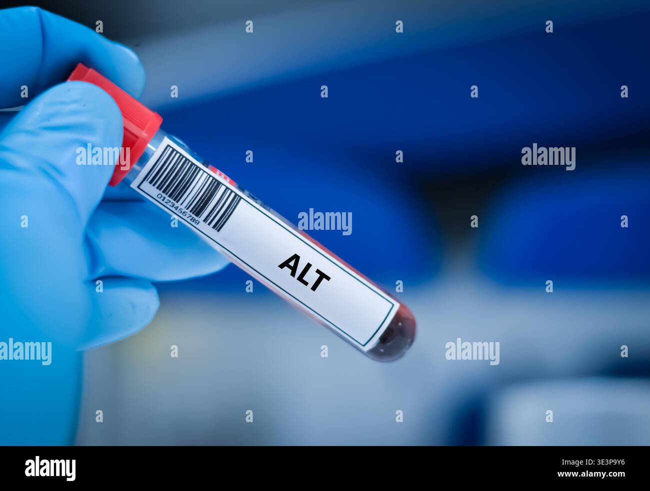 Liver function test blood hi-res stock photography and images - Alamy