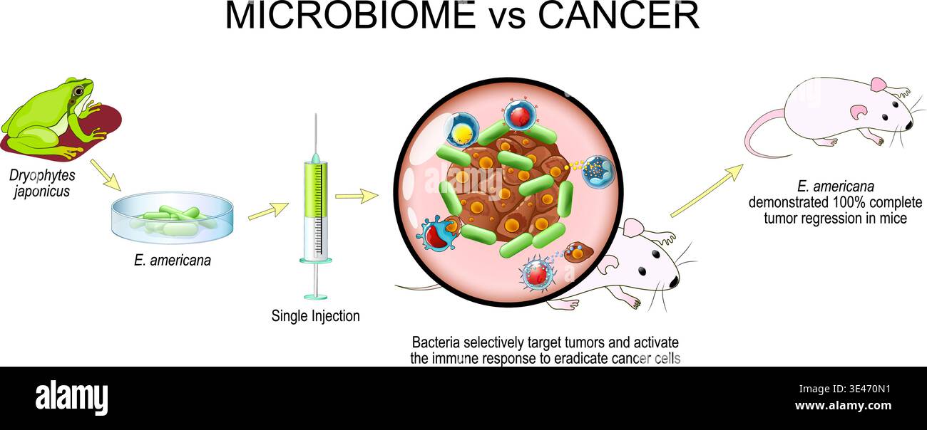 Microbiome cancer cancer therapy hi-res stock photography and images ...