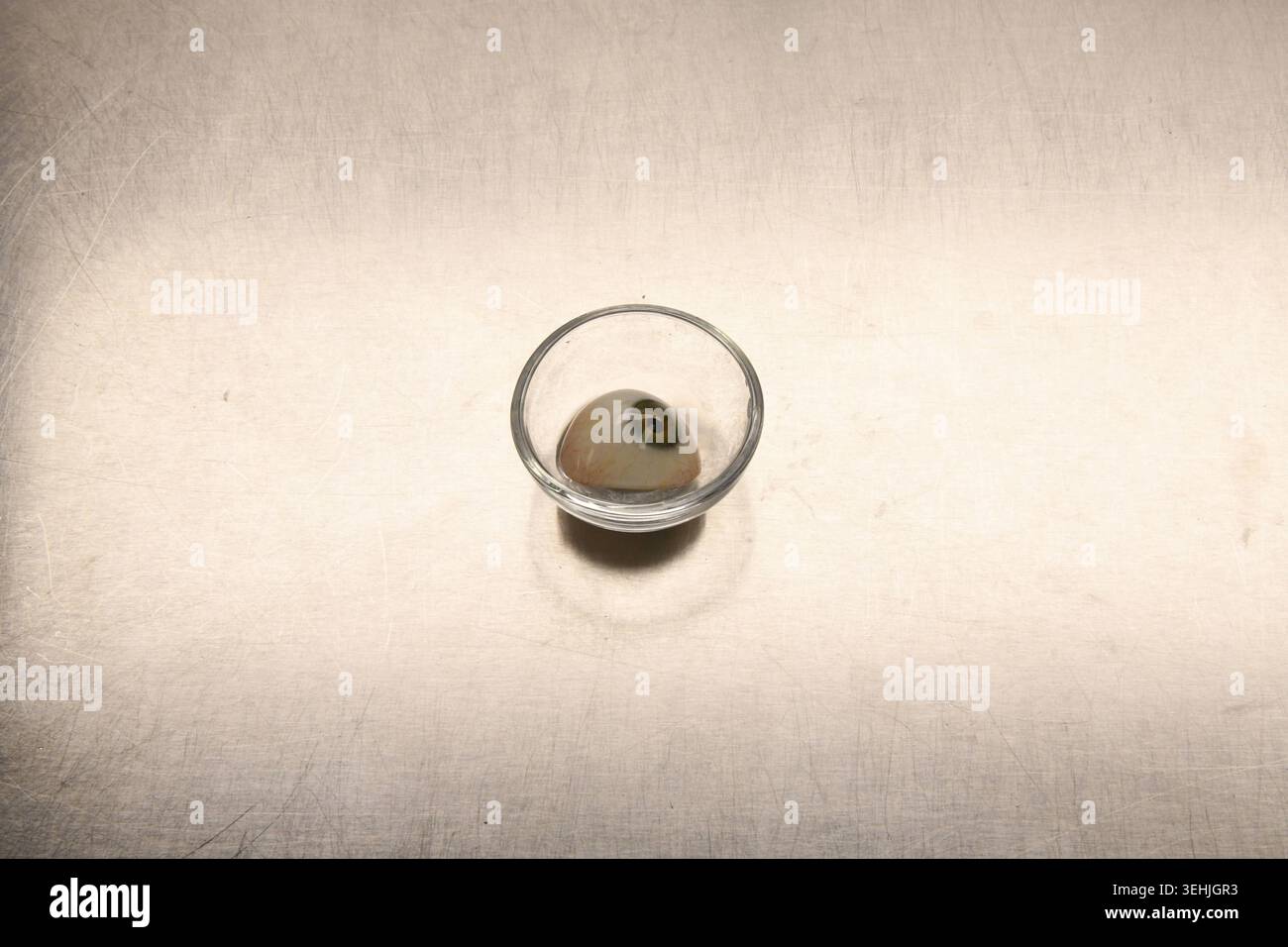 An artificial eye rests in a small, clear glass bowl on a brushed metal ...