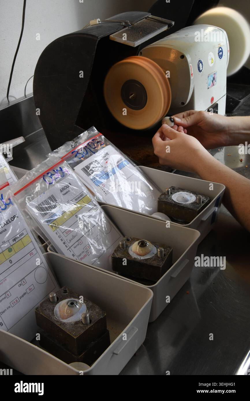 An ocularist uses a polishing wheel to refine an ocular prosthesis ...