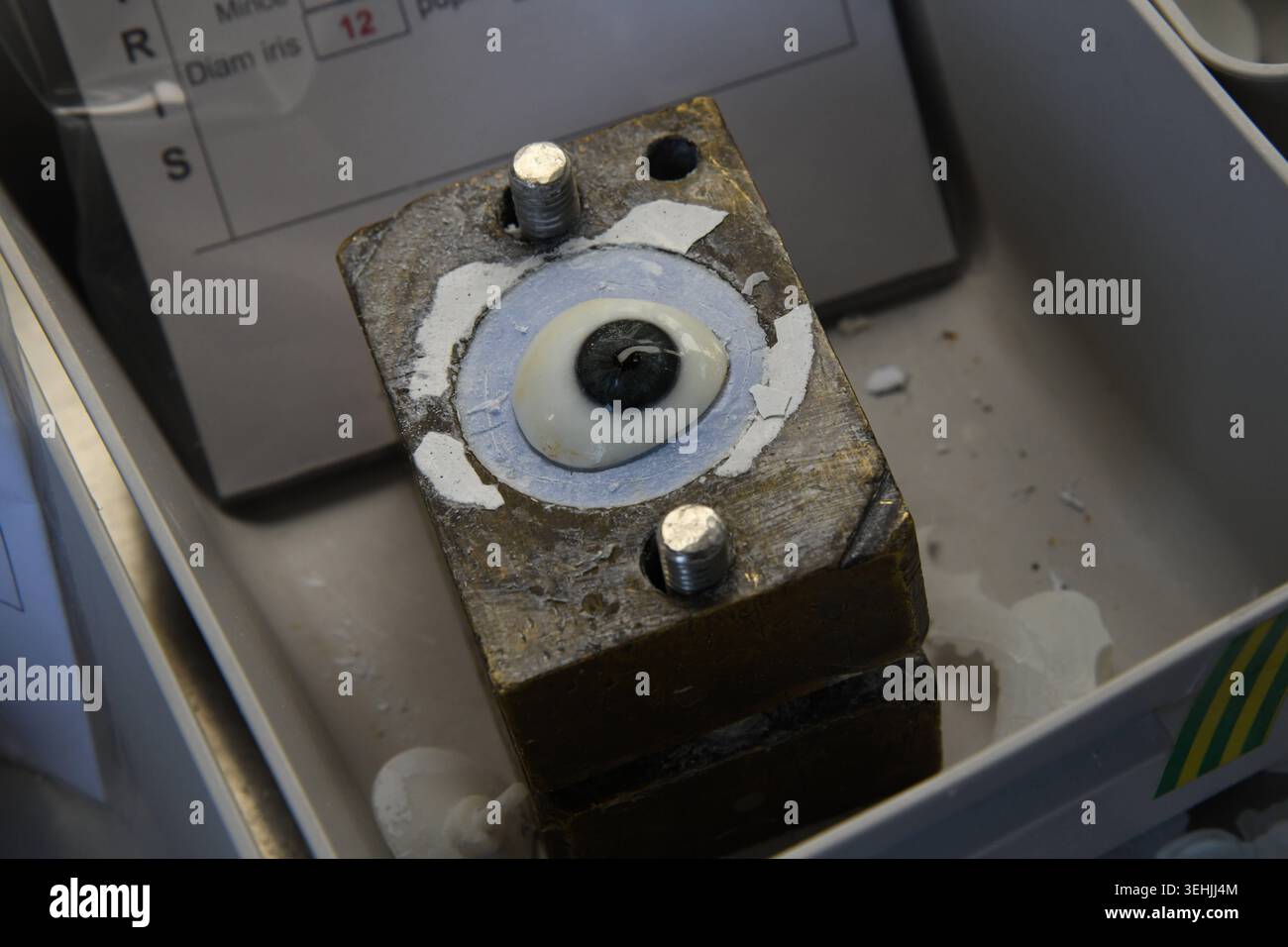 A custom-made prosthetic eye is held in a metal mold, featuring a ...