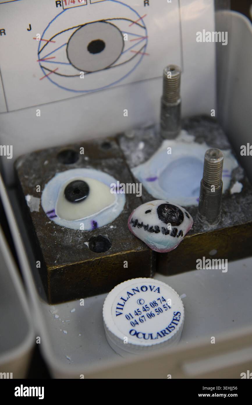 Prosthetic eyes and molds in a container, accompanied by a diagram of ...