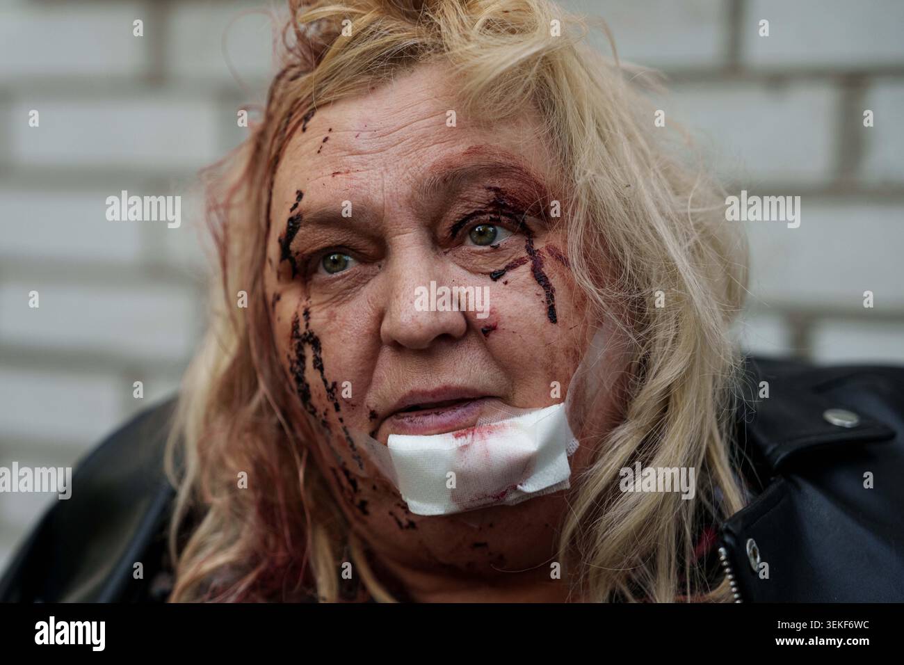 Injured Olena Dniprovska, 65, sits in the yard of her house damaged ...